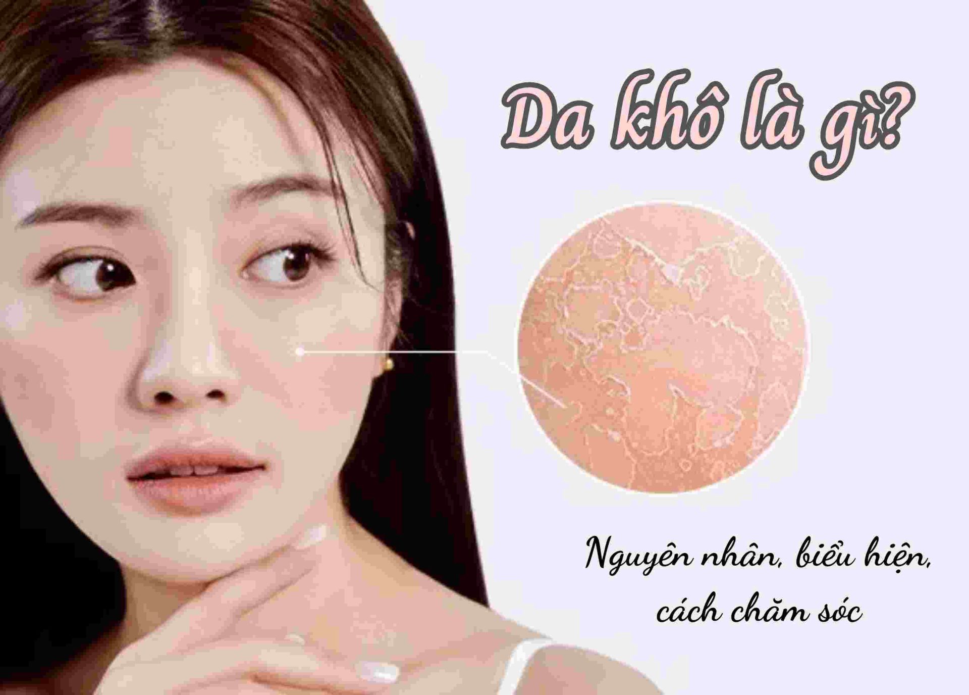 Da Khô: Nguyên Nhân, Biểu Hiện, Cách Điều Trị Khô Da | TIKI